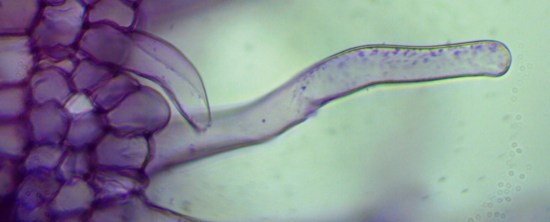 TP1 Observations cellulaires – SVT au lycée